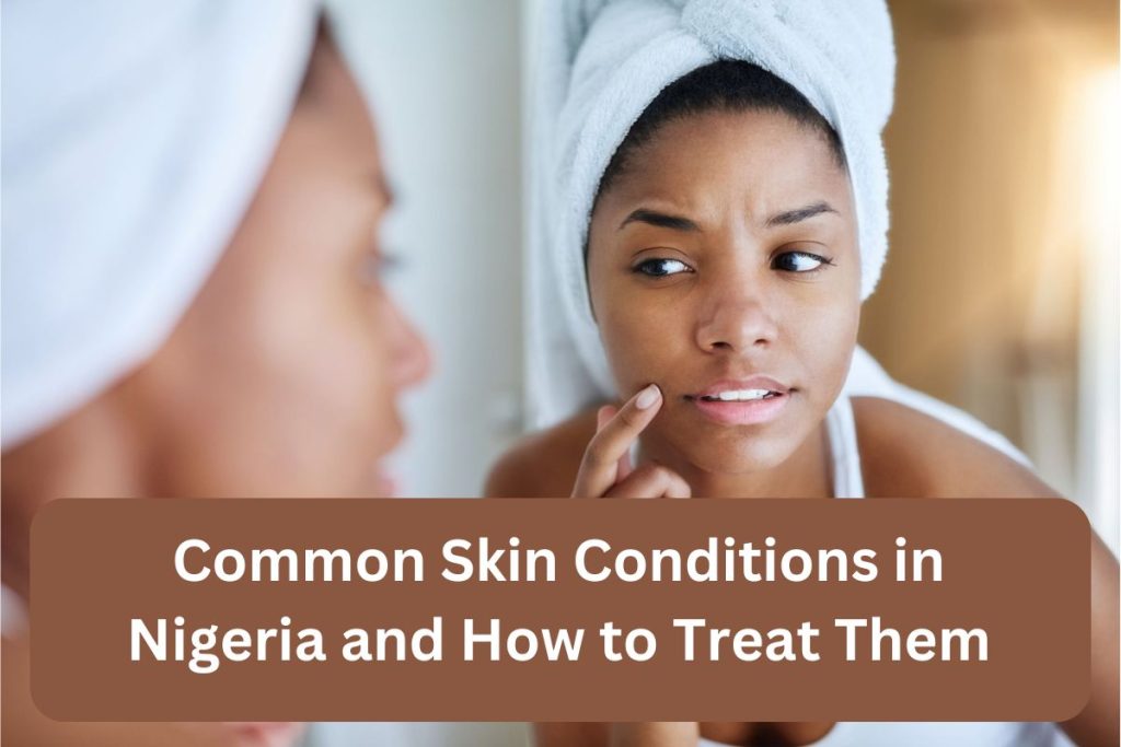 Common Skin Conditions in Nigeria and How to Treat Them | Naija Trends